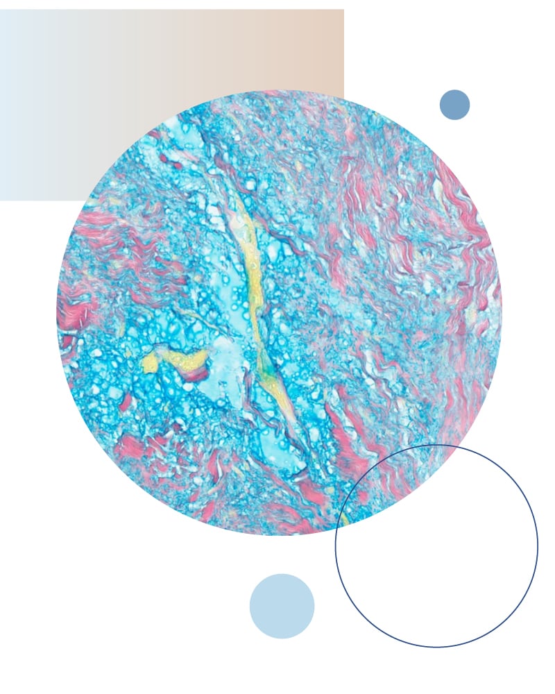 Dermatopathology | Pacific Dermatology Institute